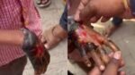 Viral video of boy with fake hand injury reveals child begging scam in ...